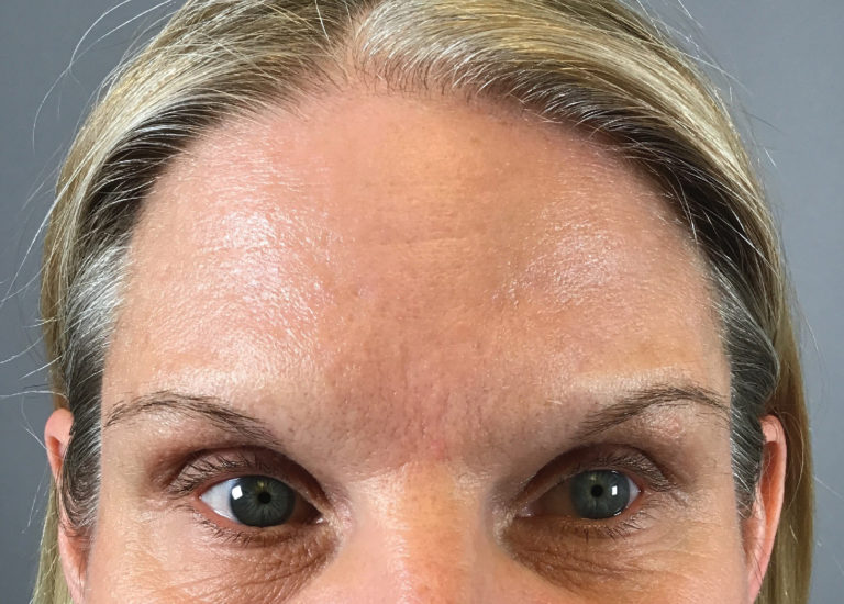 Post Treatment Cream | Custom Post Procedure Skincare