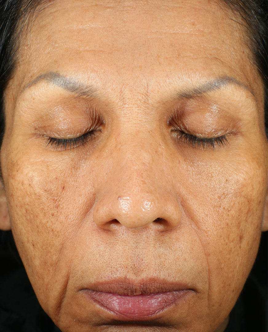 BIO CREAM FIRM: Growth Factor & Peptides Cream For Anti-Aging