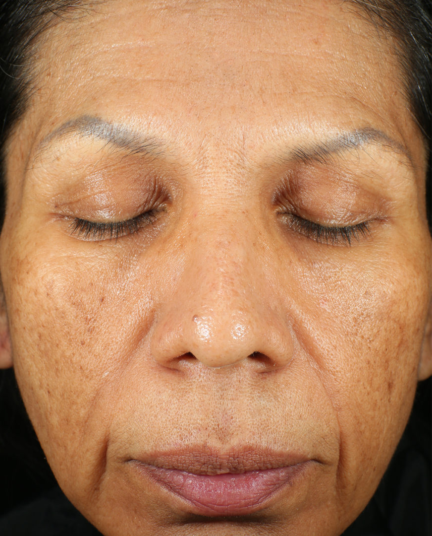 BIO CREAM FIRM: Growth Factor & Peptides Cream For Anti-Aging