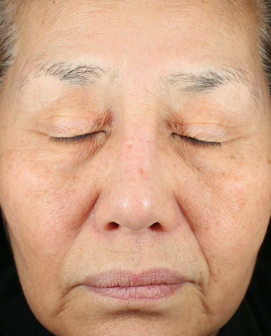 BIO CREAM FIRM: Growth Factor & Peptides Cream For Anti-Aging